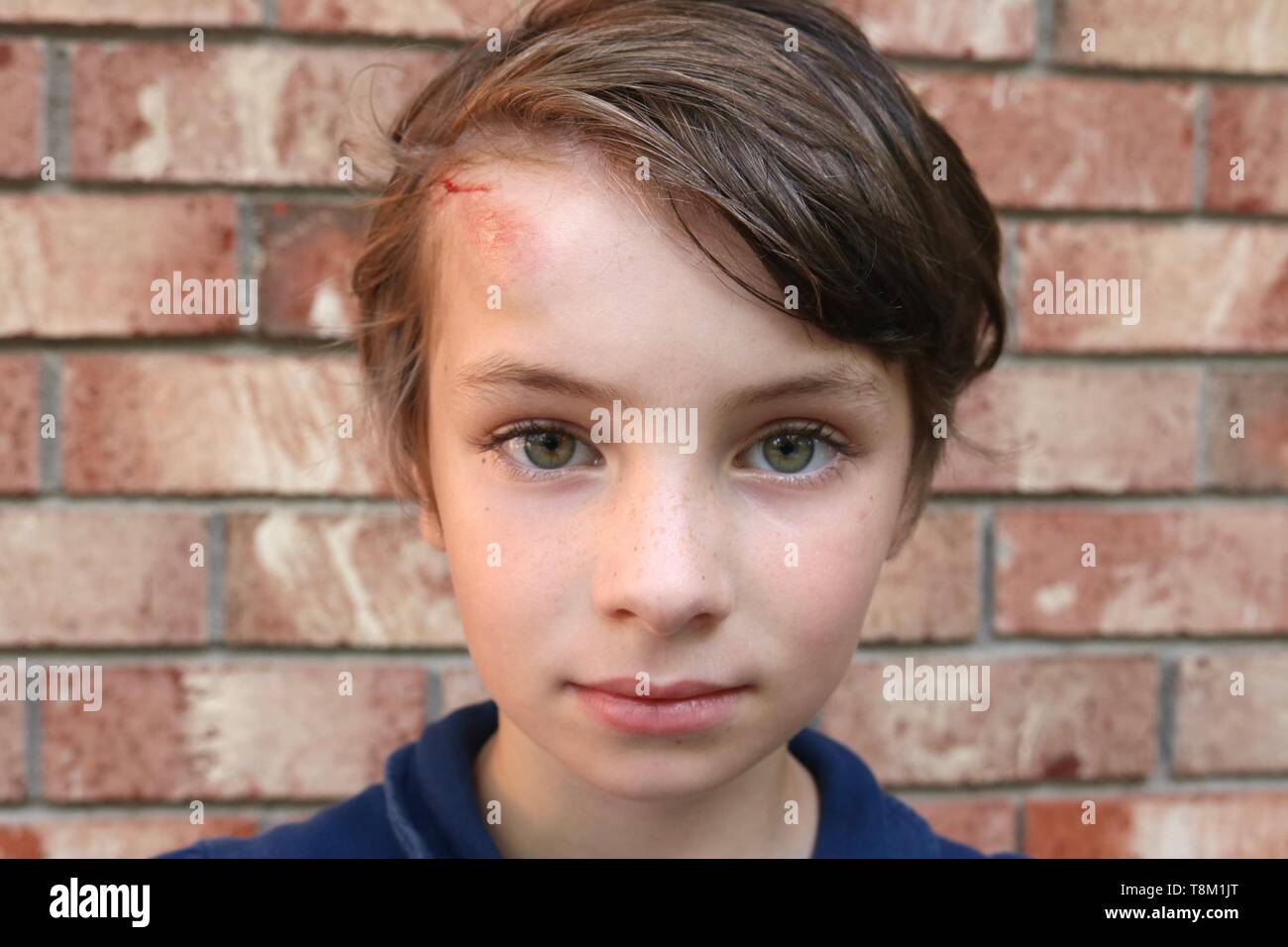 Bump on forehead hi-res stock photography and images - Alamy