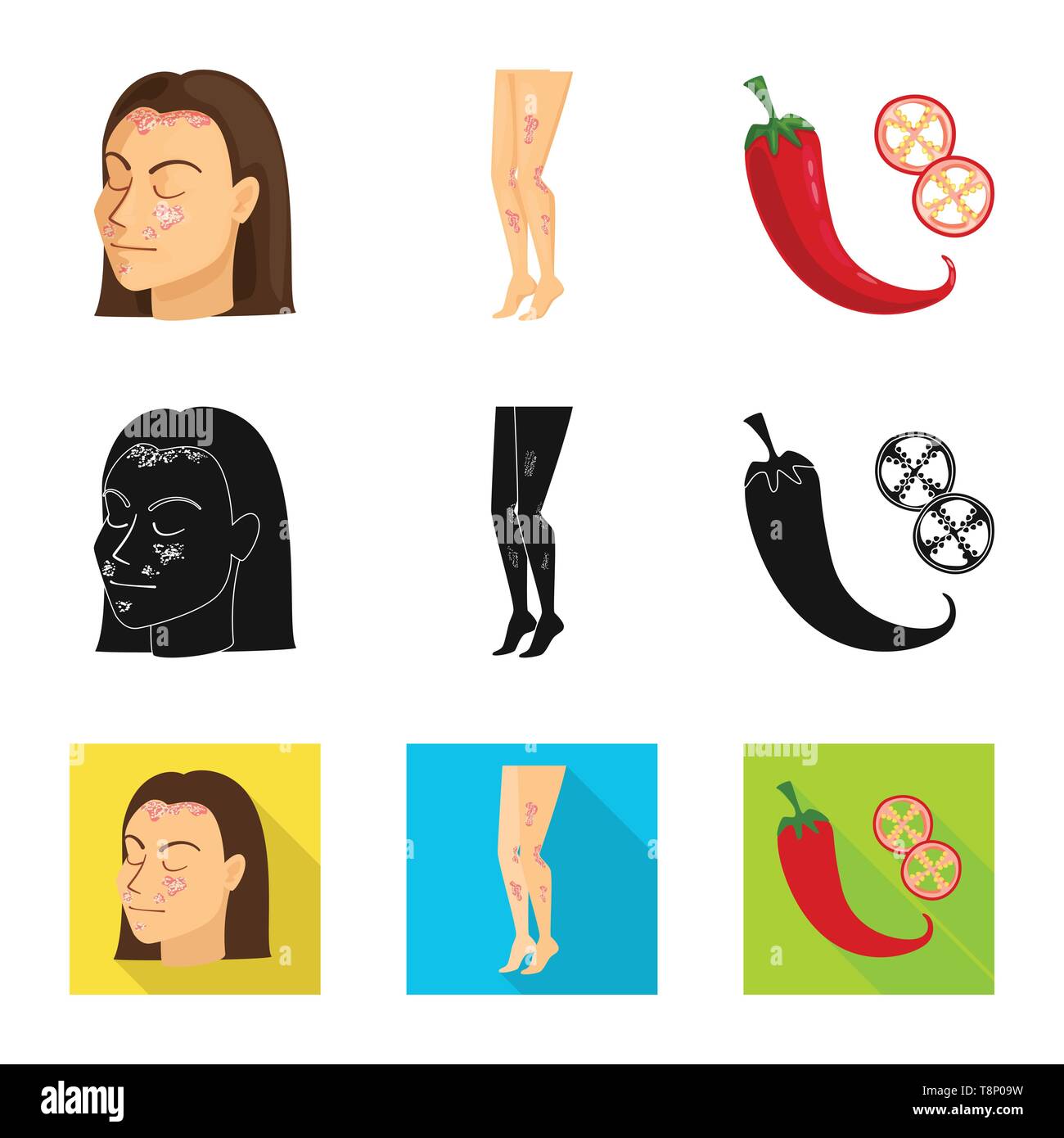 psoriasis,pepper,skin,body,chili,chronic,hot,allergy,eczema,red,stress ...