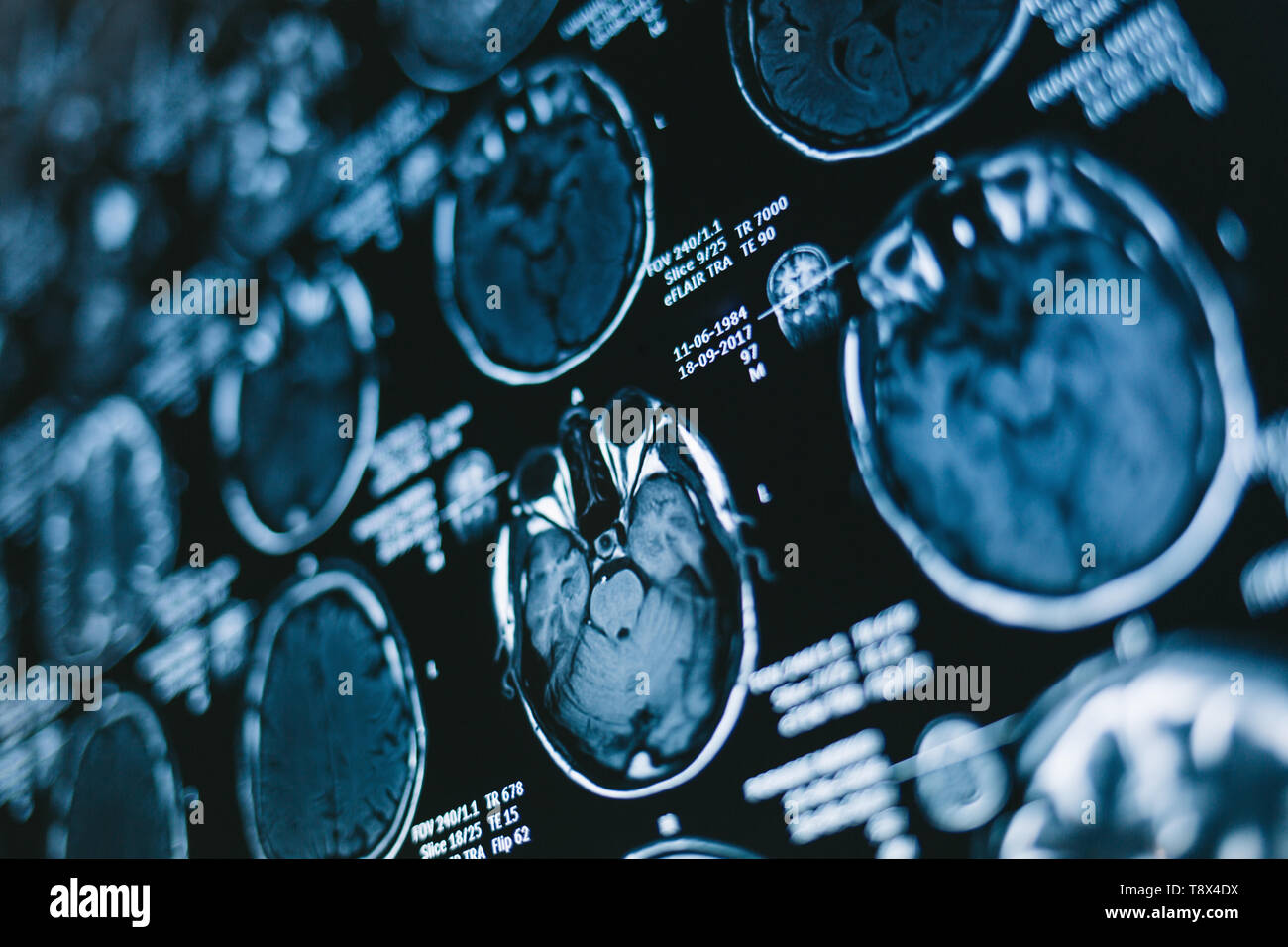 Magnetic resonance image of head. X-ray, MRI, brain, medicine, science ...