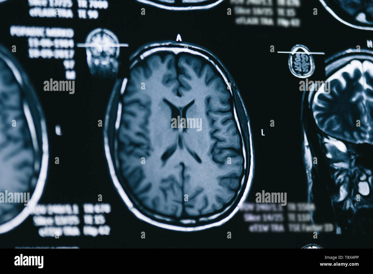 Magnetic resonance image of head. X-ray, MRI, brain, medicine, science ...