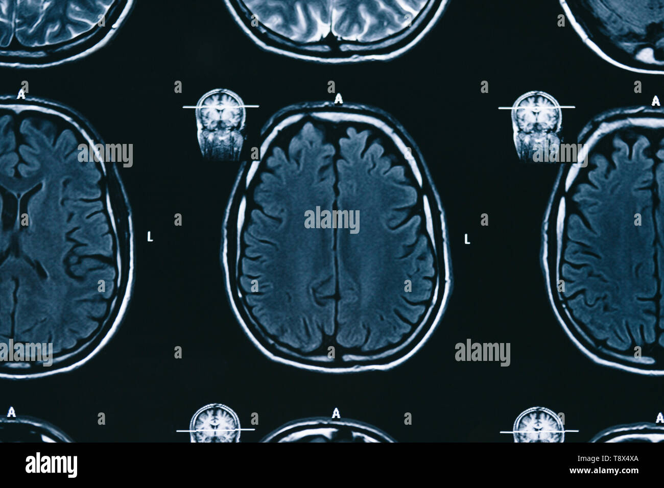 Magnetic resonance image of head. X-ray, MRI, brain, medicine, science ...