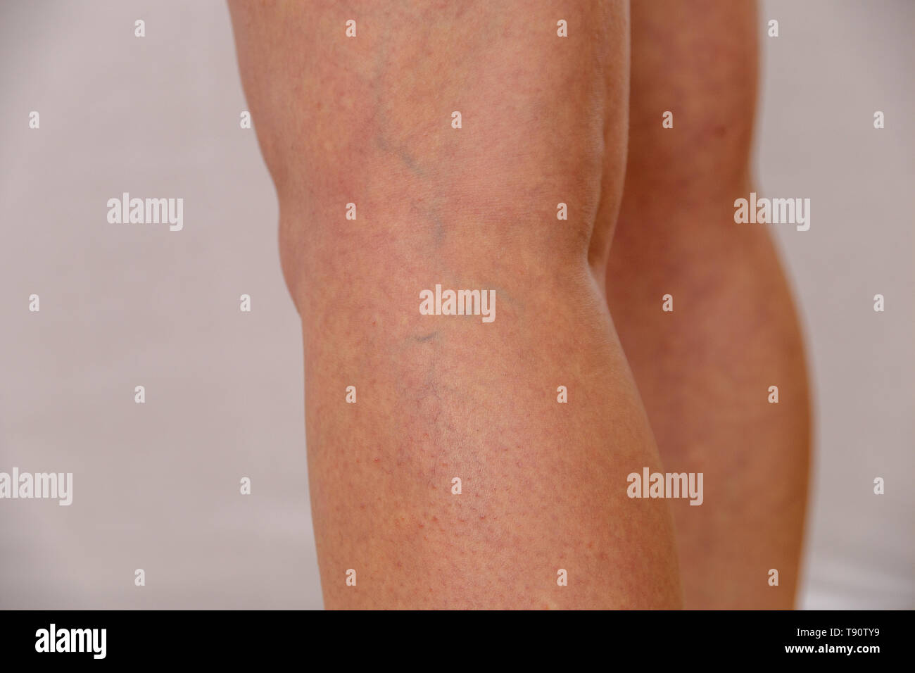 Vascular smooth hi-res stock photography and images - Alamy