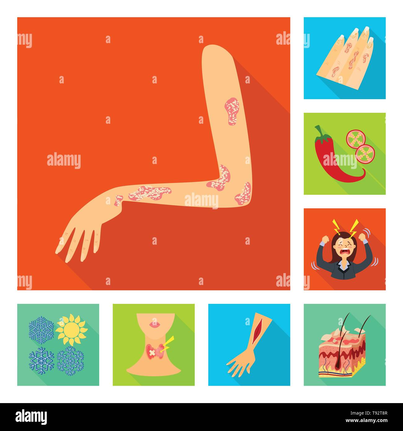 Burn injury woman arm Stock Vector Images - Alamy