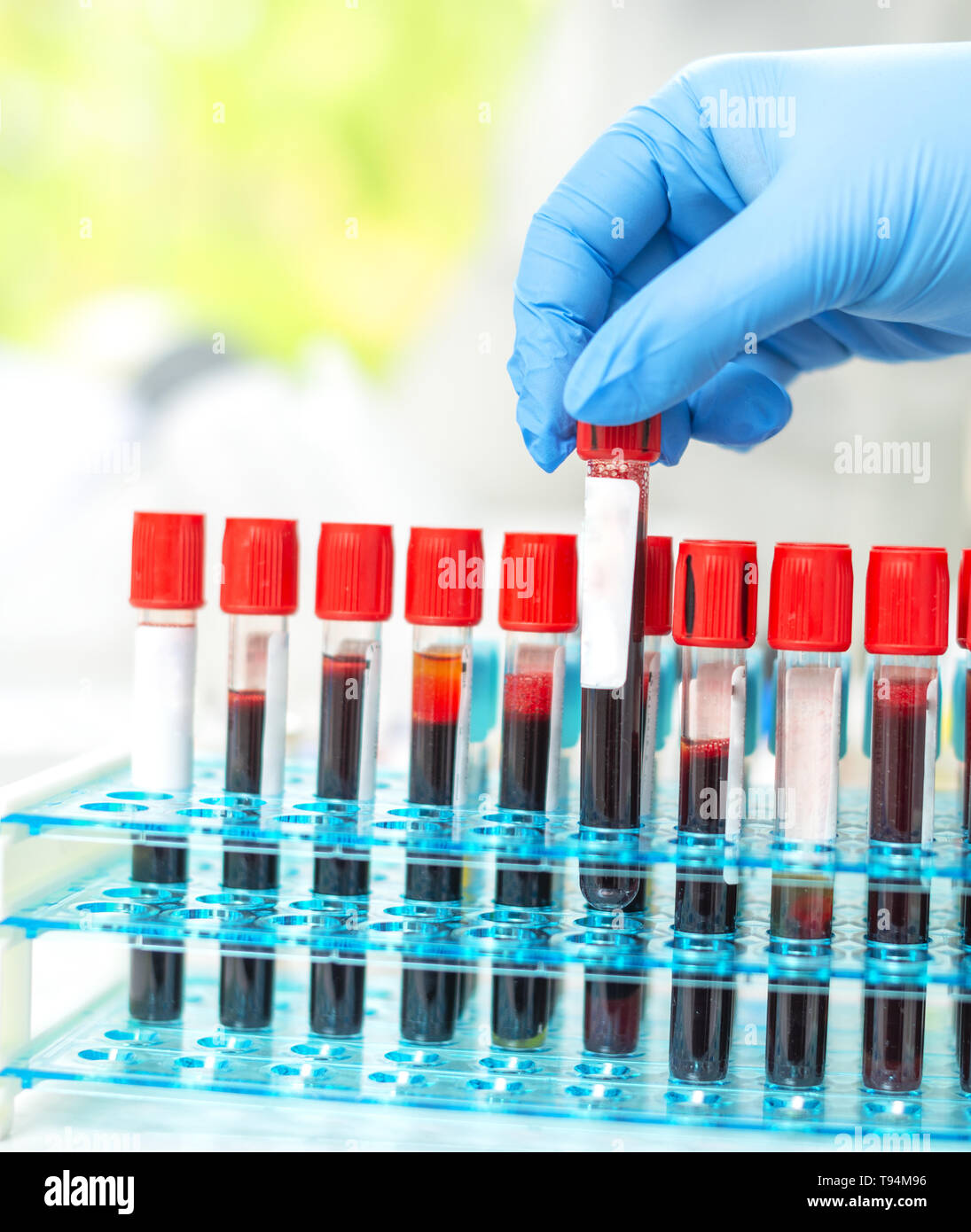 doctor hand taking a blood sample tube from a rack with machines of ...