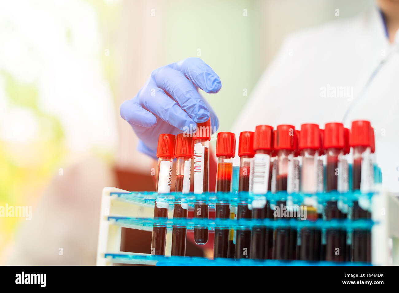 doctor hand taking a blood sample tube from a rack with machines of ...