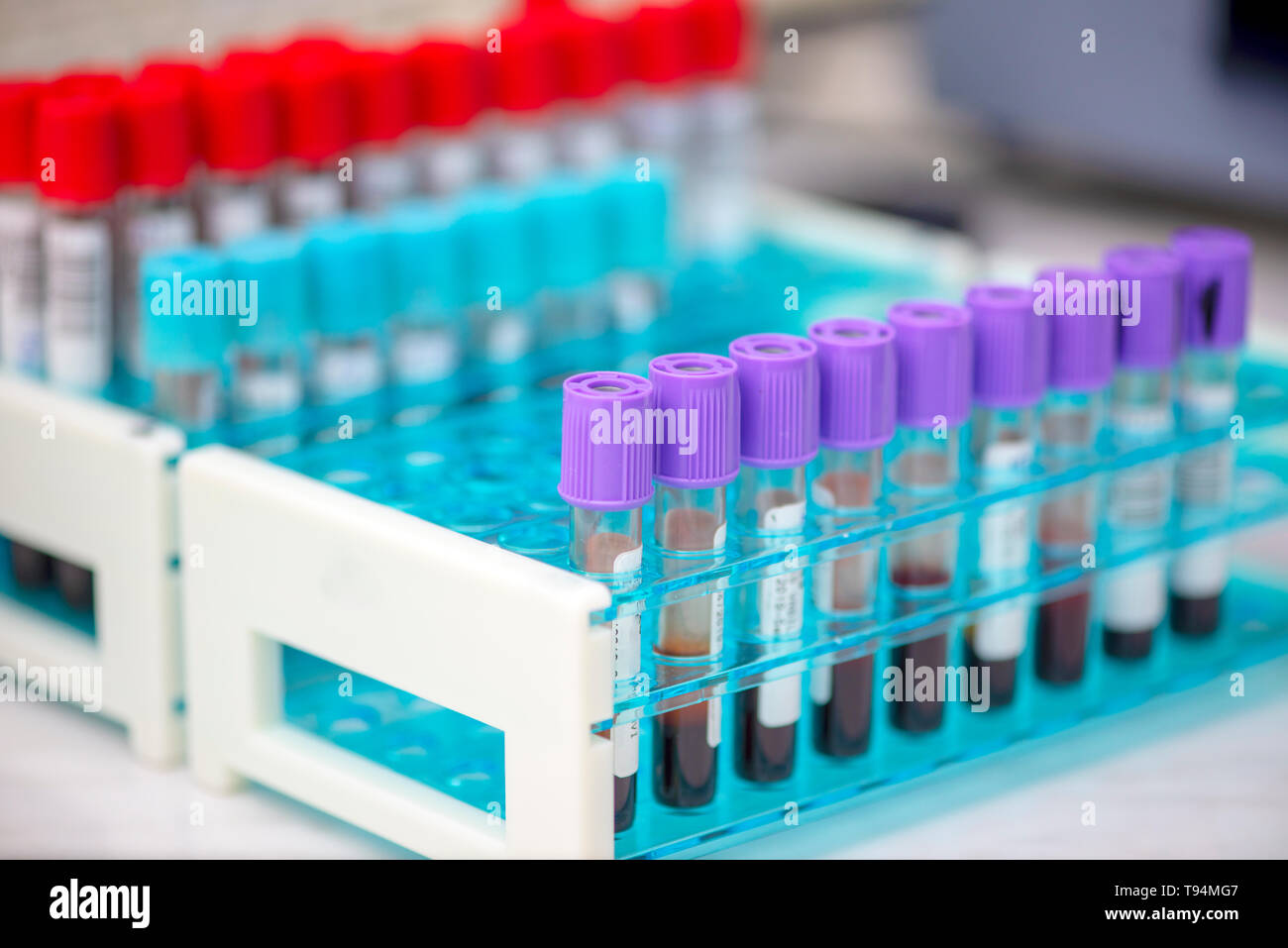Tubes of blood sample for testing Stock Photo - Alamy