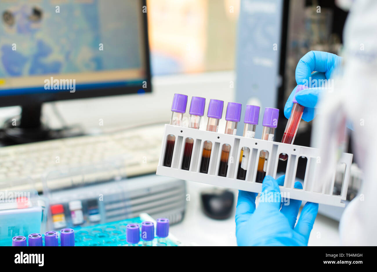 doctor hand taking a blood sample tube from a rack with machines of ...