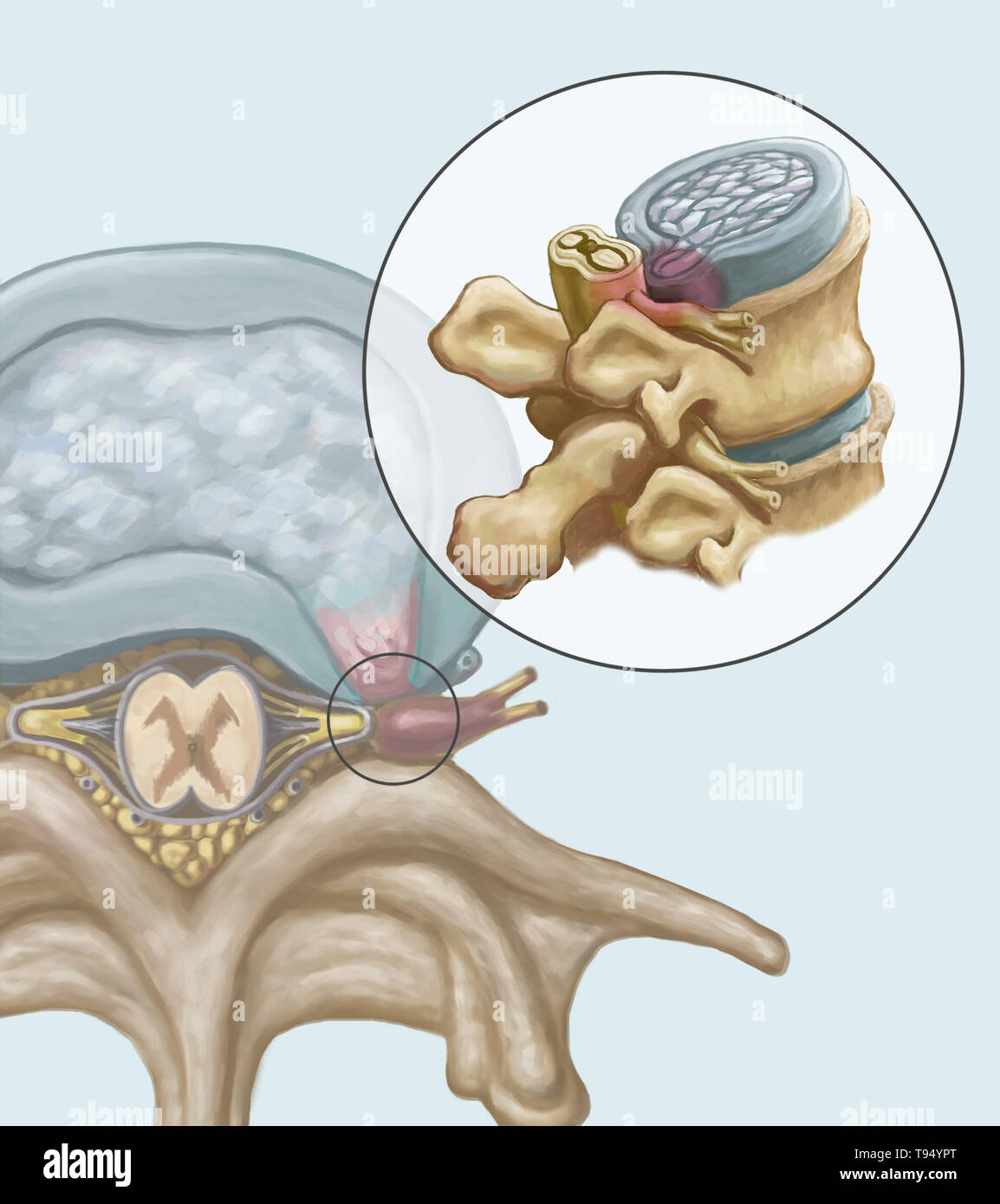 Rupture disk hi-res stock photography and images - Alamy