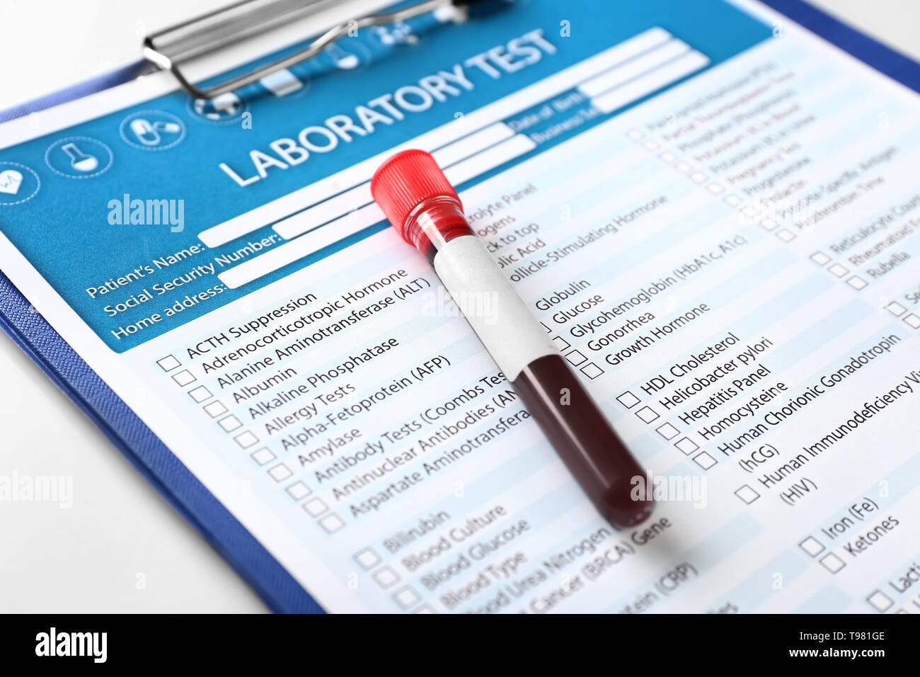 Blood analyses hi-res stock photography and images - Alamy