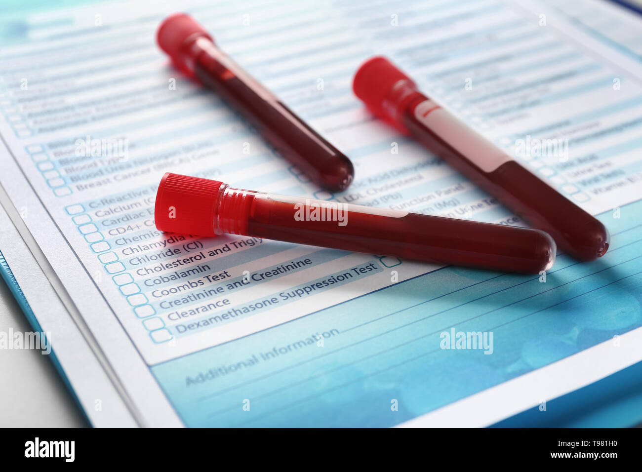 Blood samples on document with result of analyses Stock Photo - Alamy