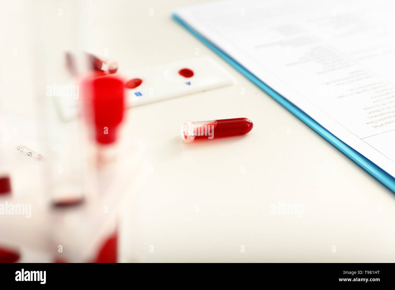 Blood samples on table in laboratory Stock Photo - Alamy