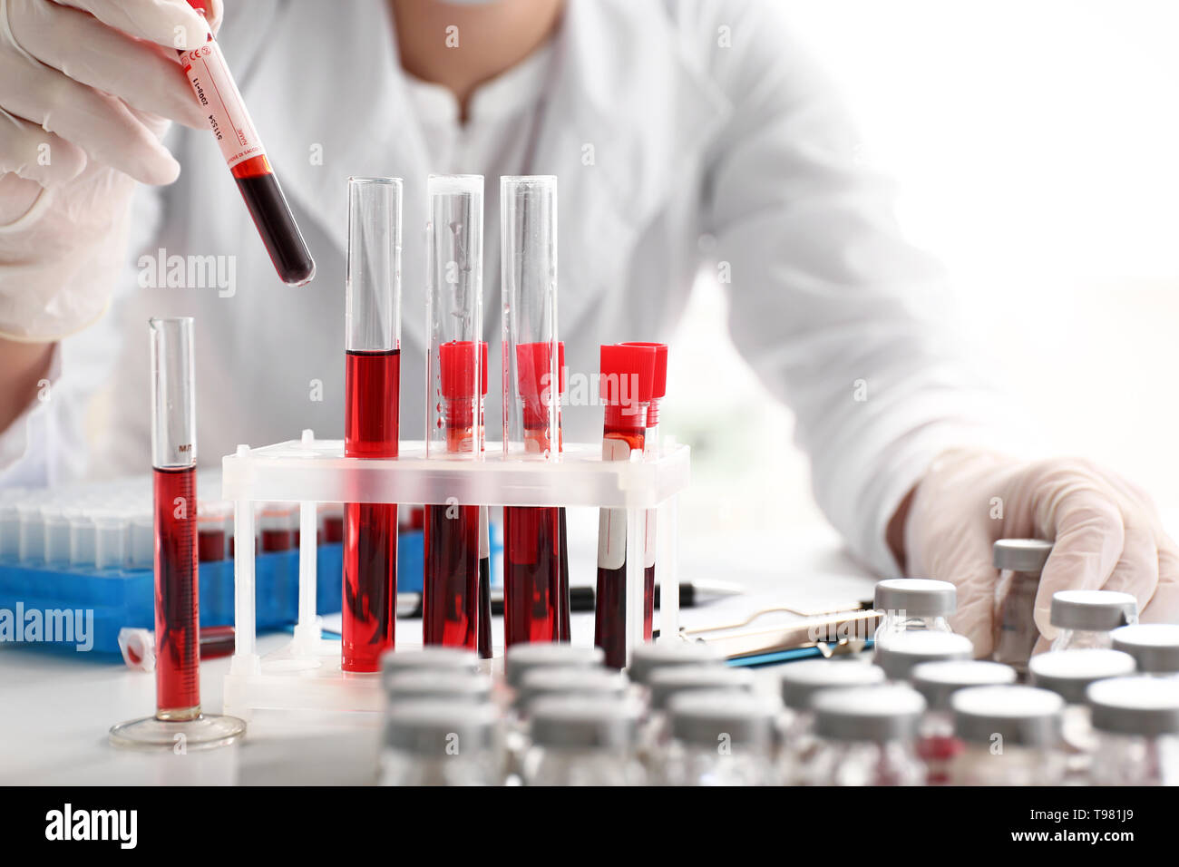 Woman working blood samples hi-res stock photography and images - Alamy