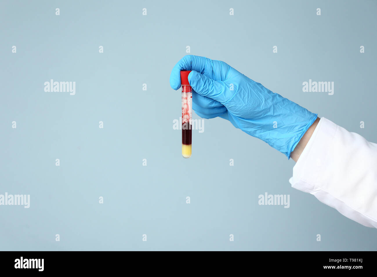 Hand of laboratory assistant holding test tube with blood sample on ...