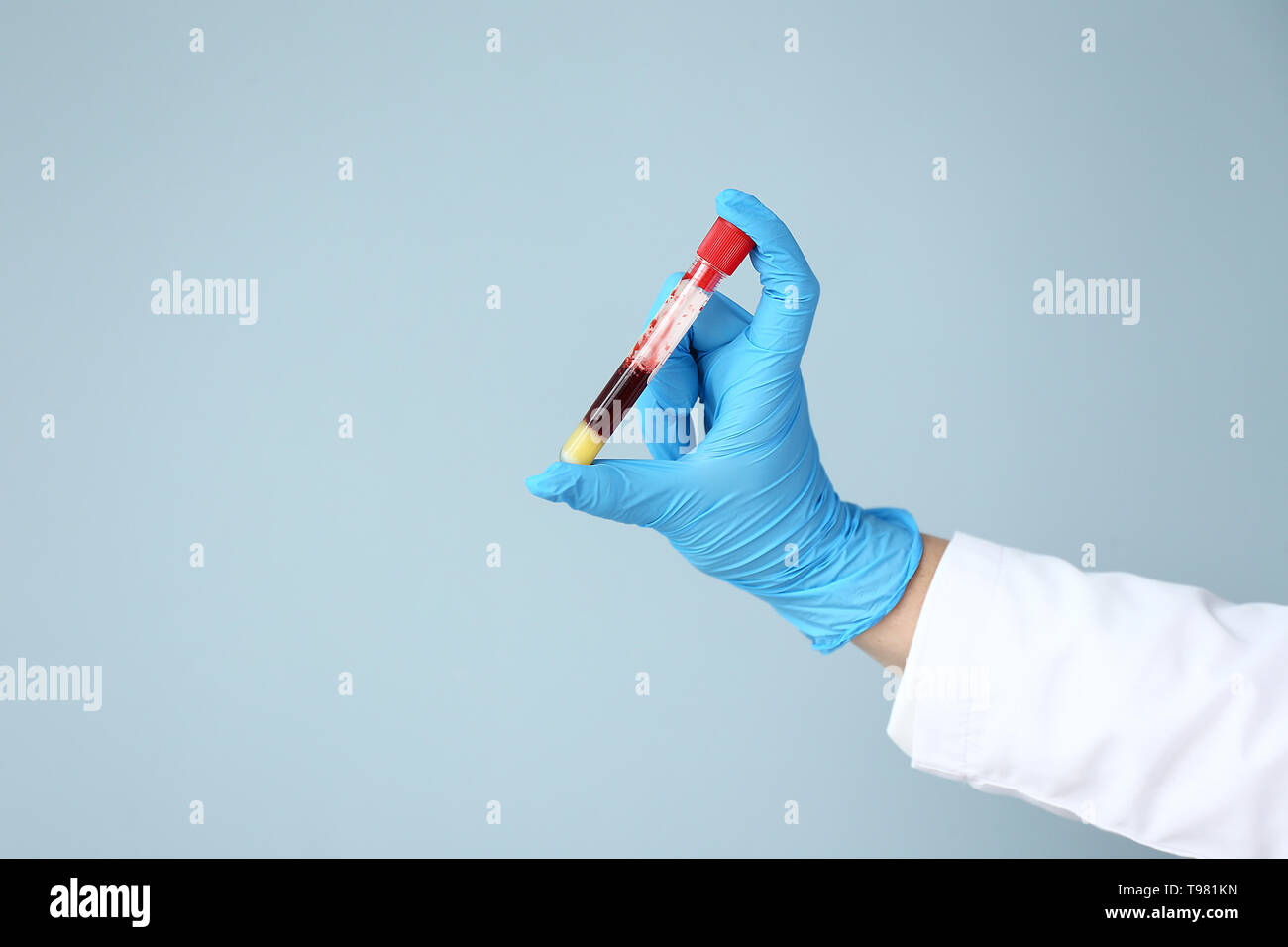Hand of laboratory assistant holding test tube with blood sample on ...