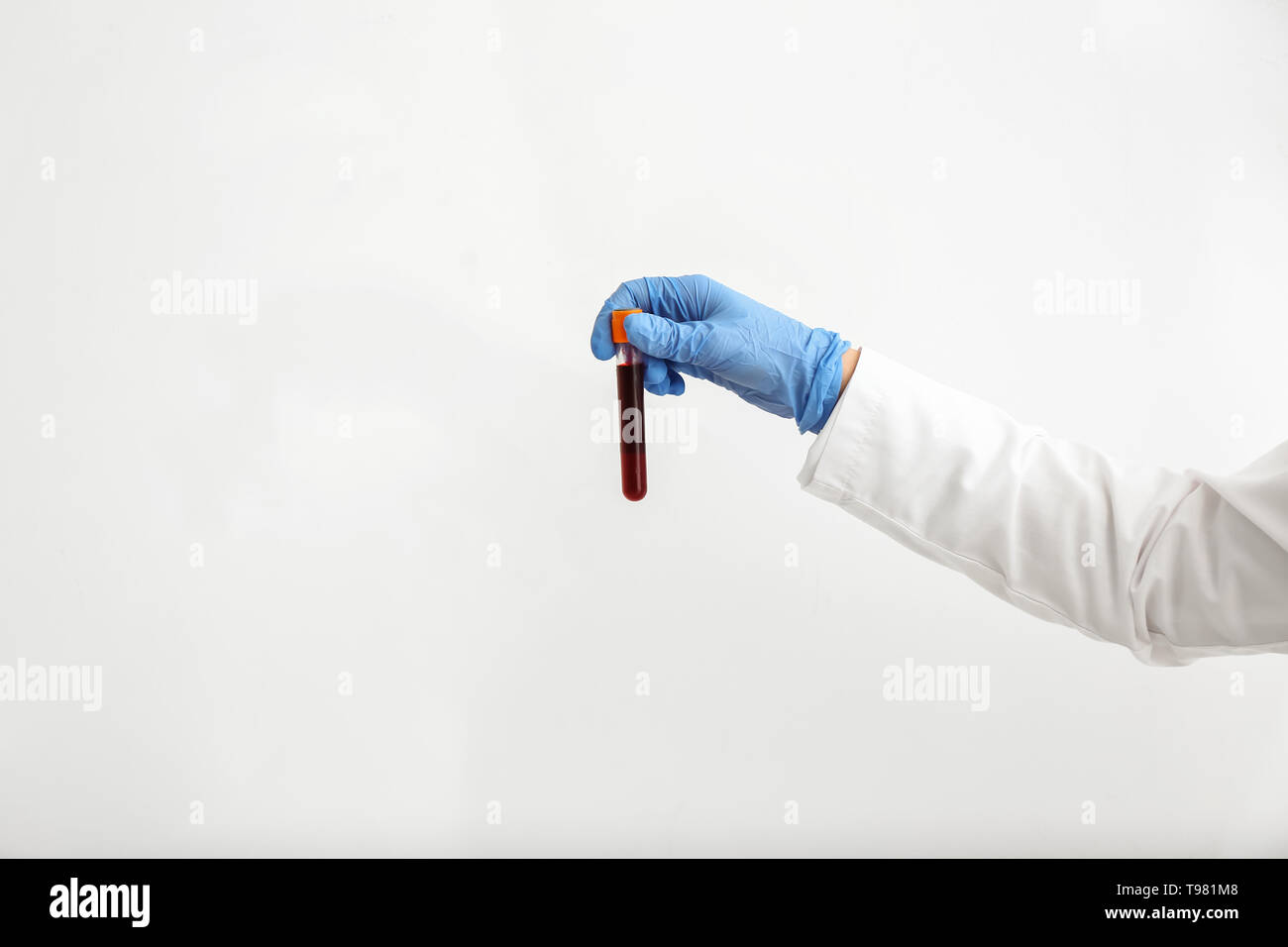 Hand of laboratory assistant holding test tube with blood sample on ...