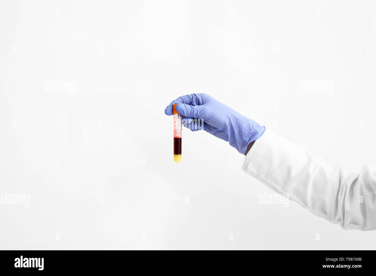 Hand of laboratory assistant holding test tube with blood sample on ...