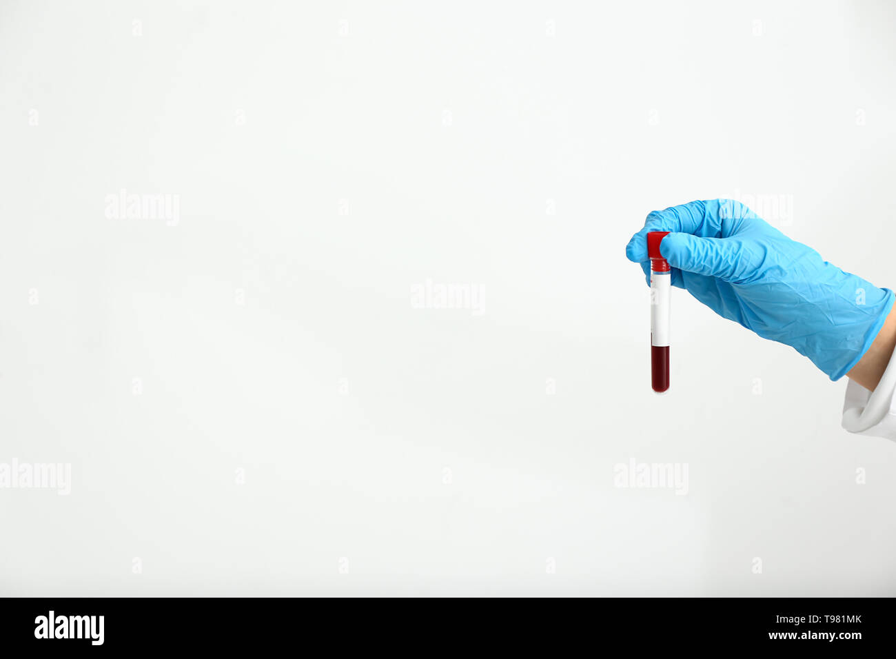 Hand of laboratory assistant holding test tube with blood sample on ...