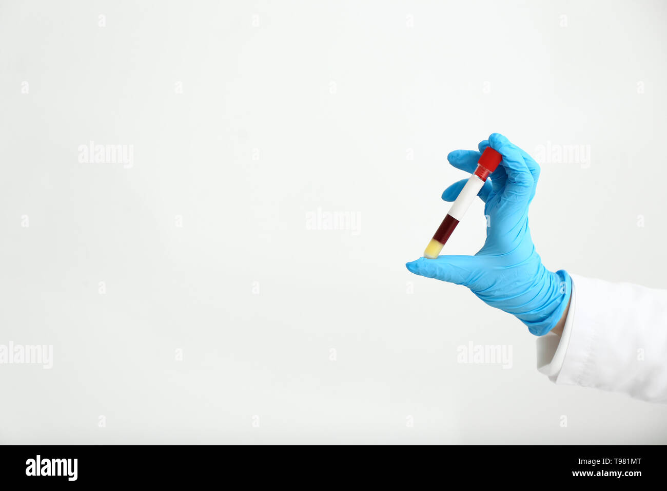 Hand of laboratory assistant holding test tube with blood sample on ...