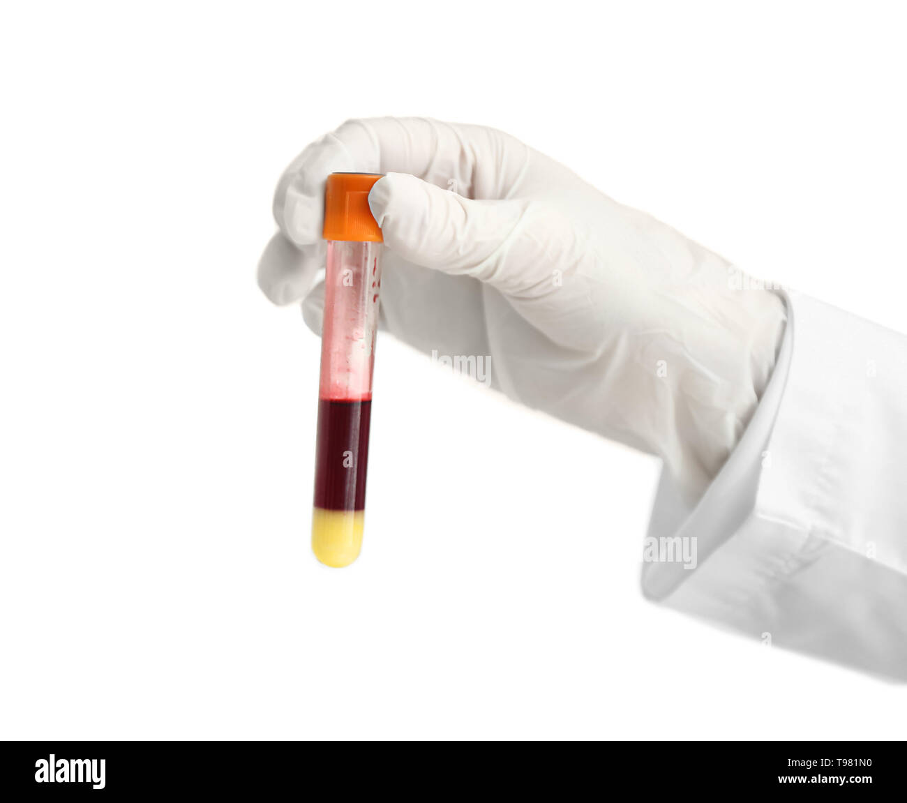 Hand of laboratory assistant holding test tube with blood sample on ...