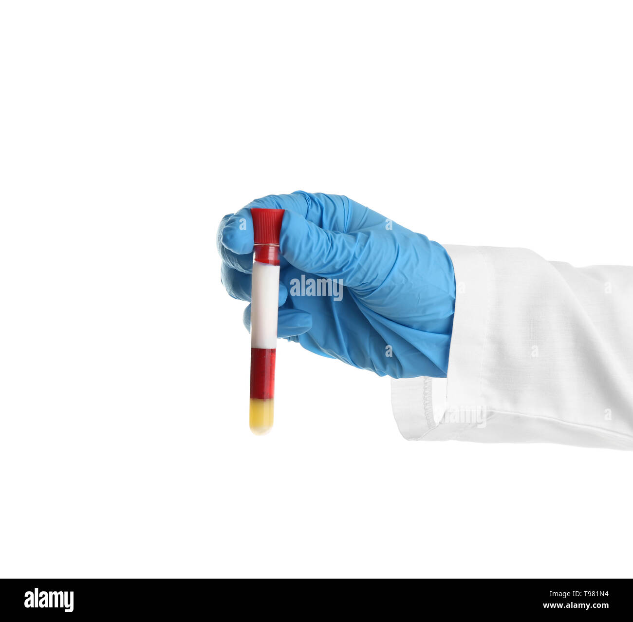 Hand of laboratory assistant holding test tube with blood sample on ...