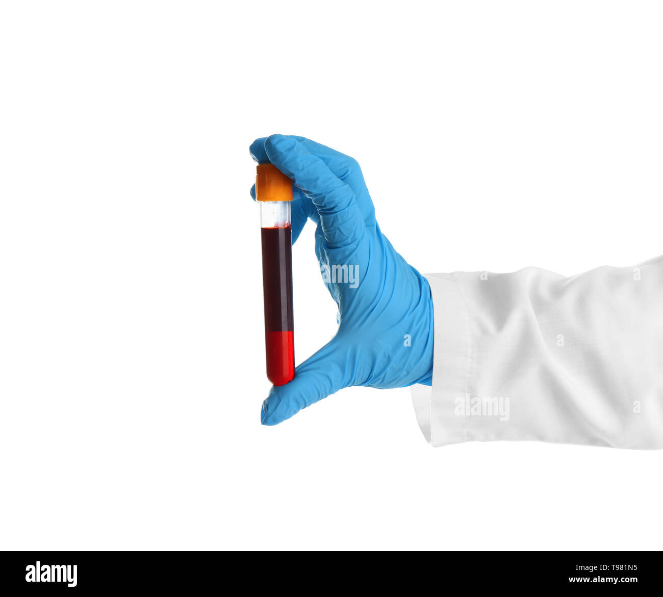 Hand of laboratory assistant holding test tube with blood sample on ...