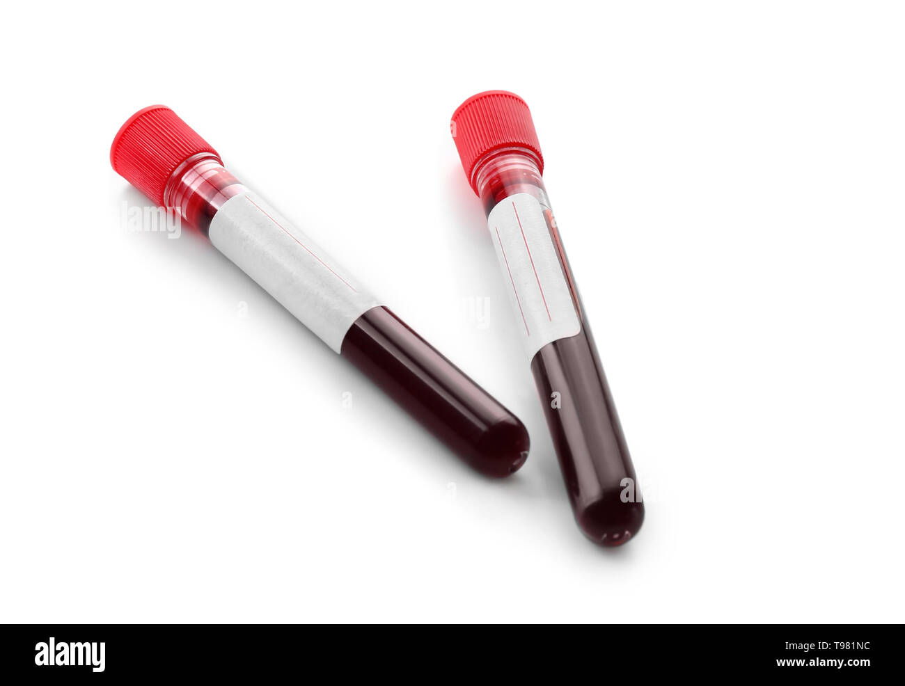 Test tubes with blood samples on white background Stock Photo - Alamy