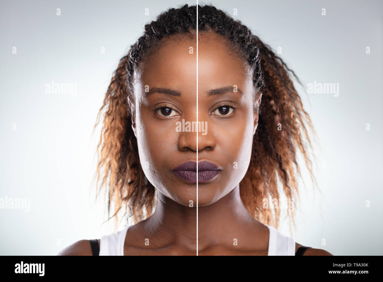 Close-up Of A Young Woman's Face Before And After Cosmetic Procedure ...