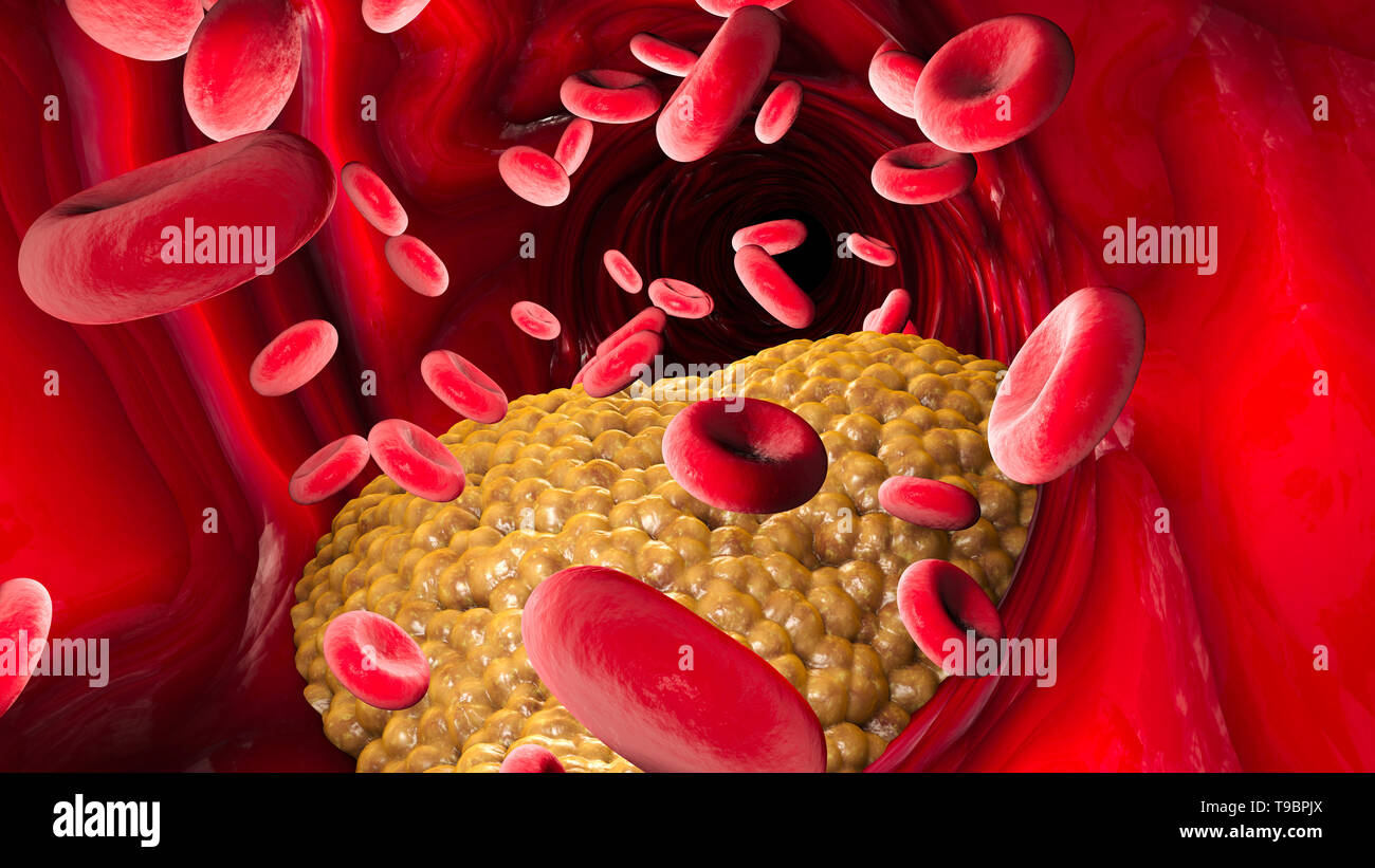 Fat cells hi-res stock photography and images - Alamy