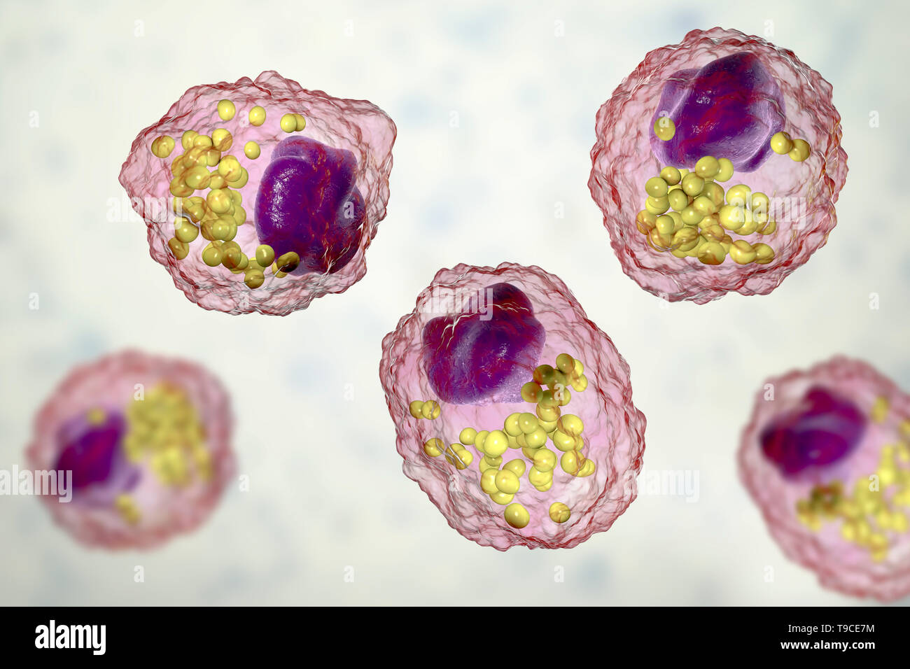 Macrophage foam cell, illustration Stock Photo - Alamy
