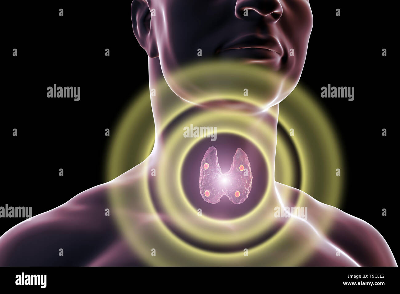 Parathyroid glands, illustration Stock Photo - Alamy