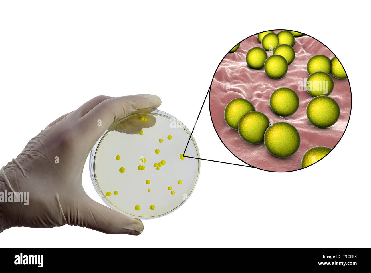 Micrococcus luteus hi-res stock photography and images - Alamy