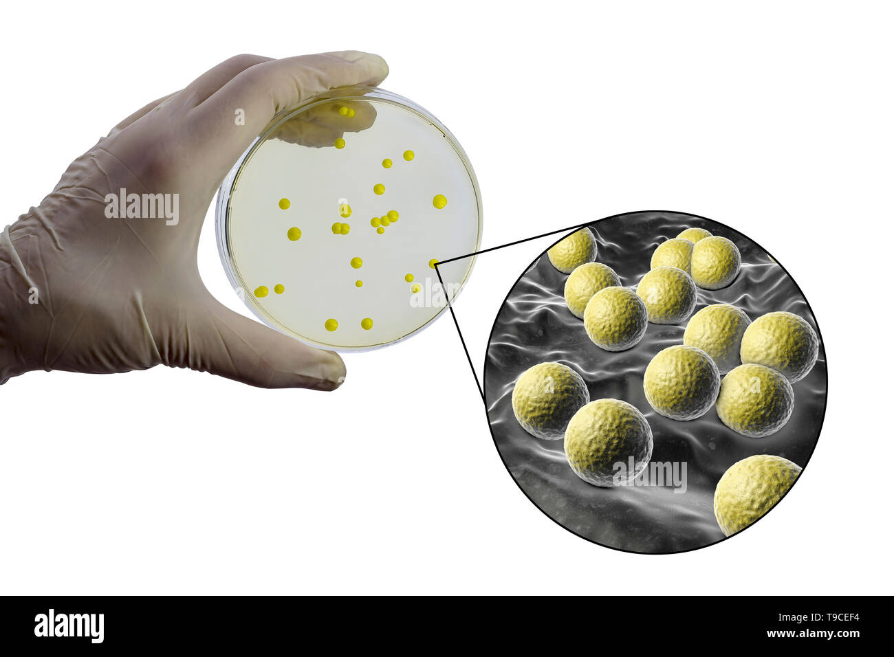 Micrococcus luteus hi-res stock photography and images - Alamy