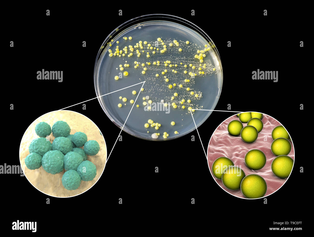 Bacterial culture hi-res stock photography and images - Alamy