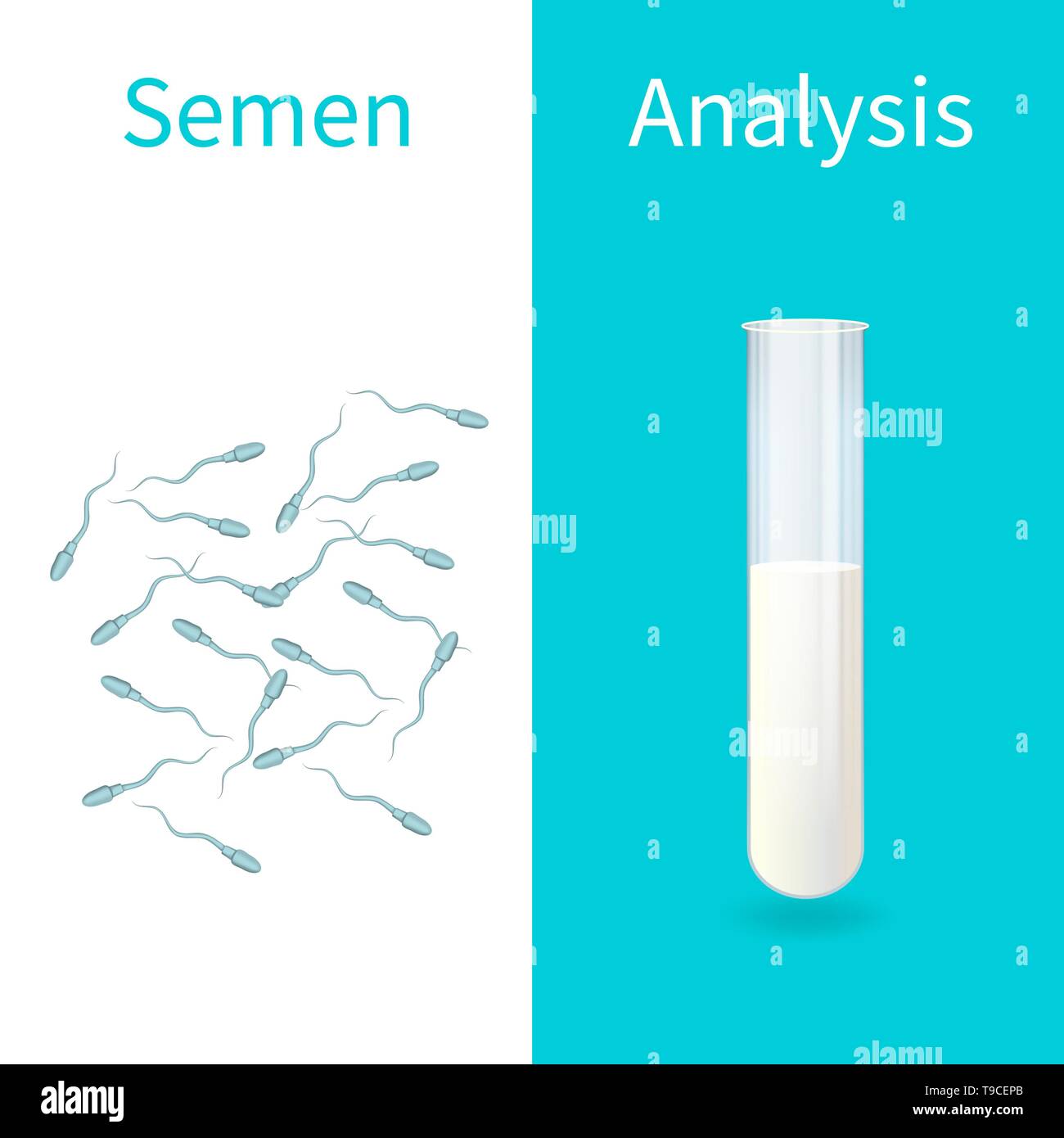 Semen analysis, illustration Stock Photo - Alamy