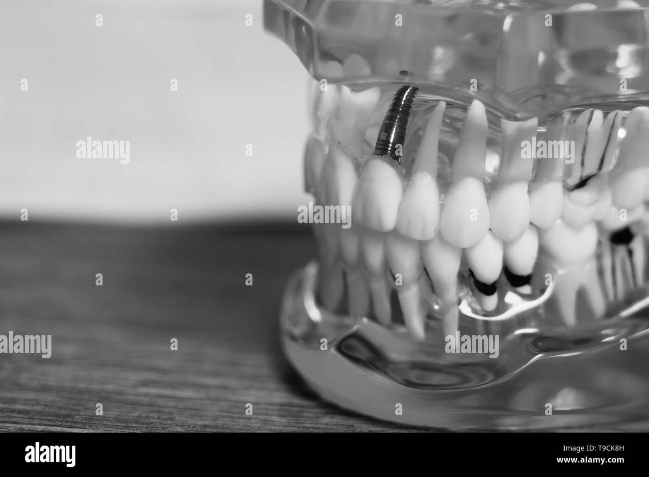 Teeth roots hi-res stock photography and images - Alamy