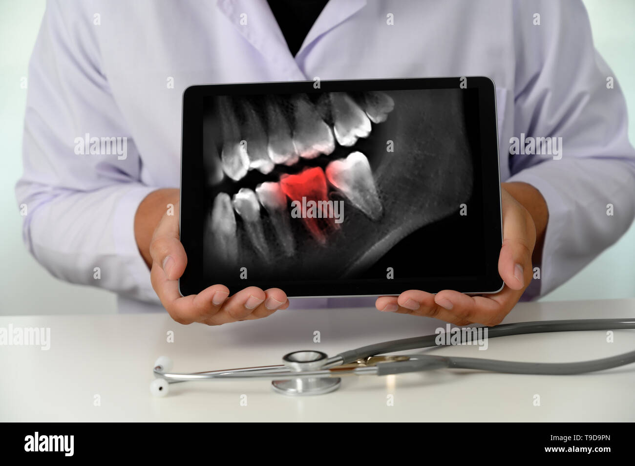 Dentist dental tool to teeth x-ray work Looking At Teeth X-ray On ...