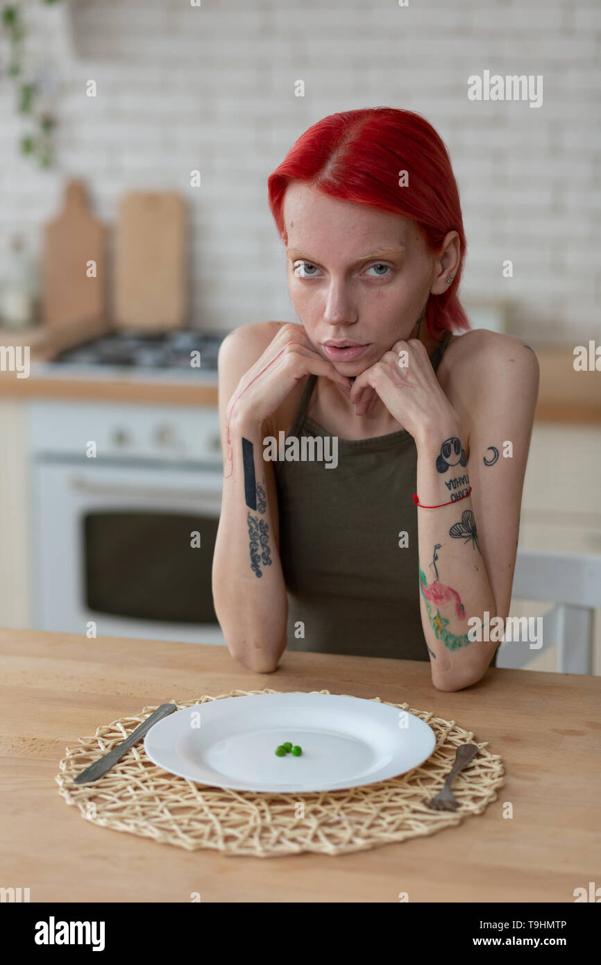 Anorexia Woman Girl Stock Photos & Anorexia Woman Girl Stock Images - Alamy
