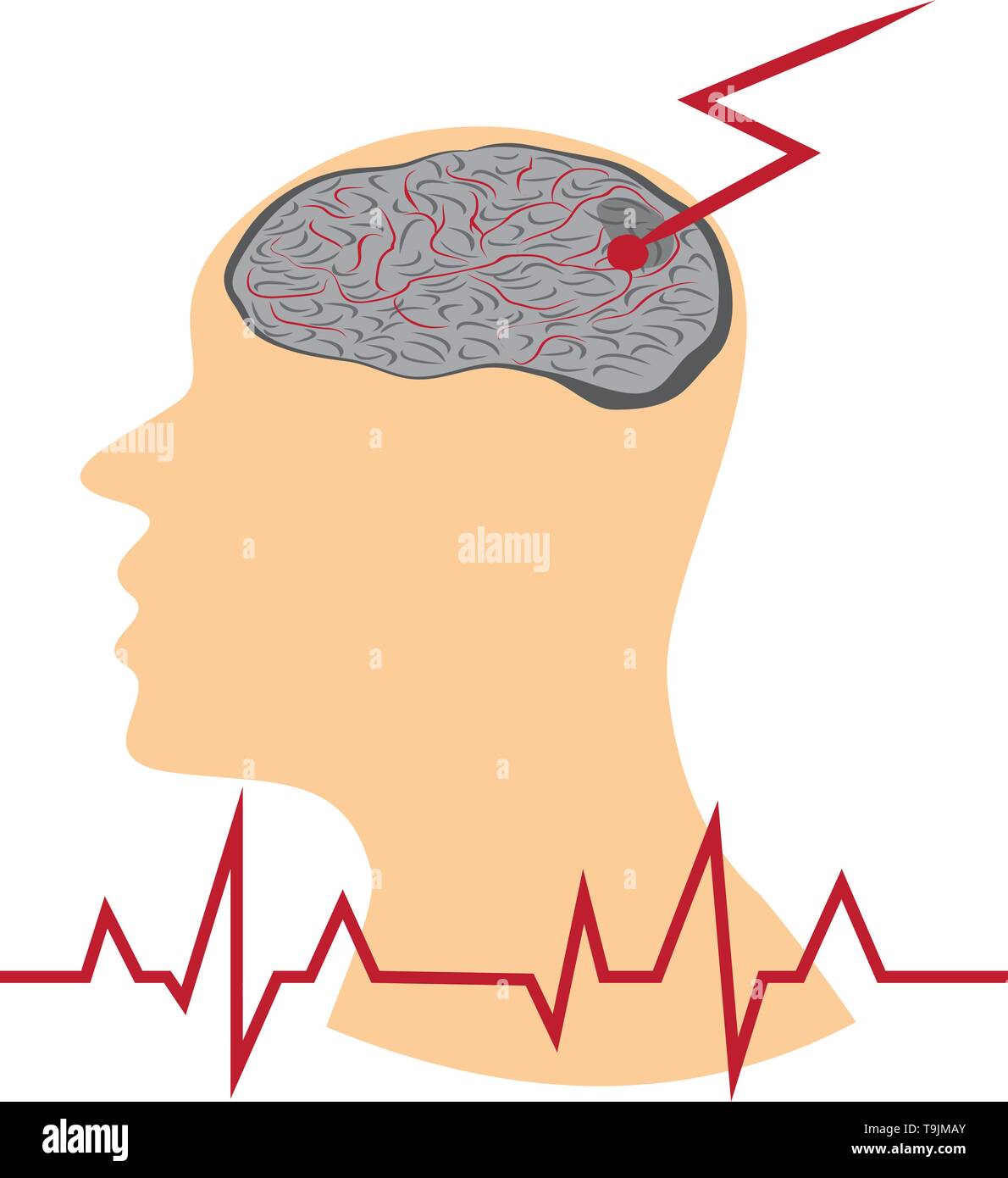 Stroke develope in human brains vecroe illustration Stock Vector Image ...