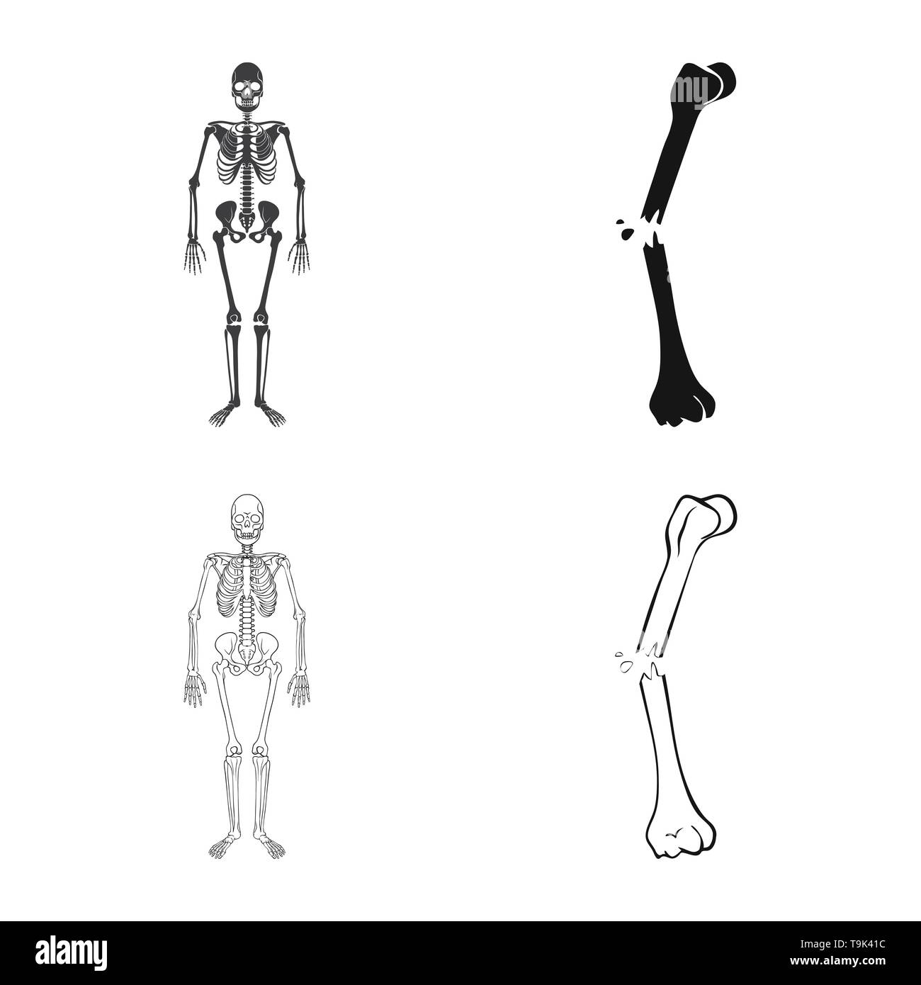 musculoskeletal,fracture,scientific,pain,skeletal,bias,system,injury ...