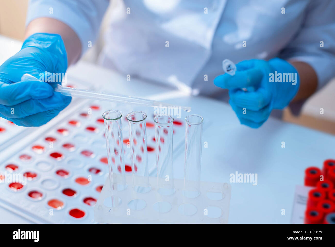 Laboratory determination of blood type. Blood test Stock Photo - Alamy