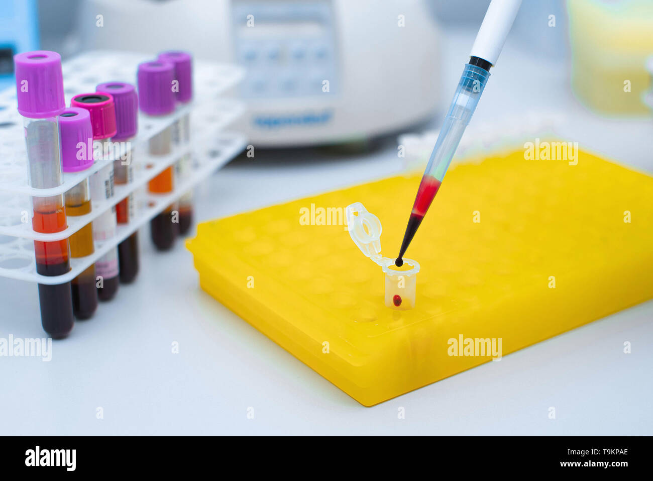 Dna test in the lab. Dispenser with blood and test tubes close-up. A ...