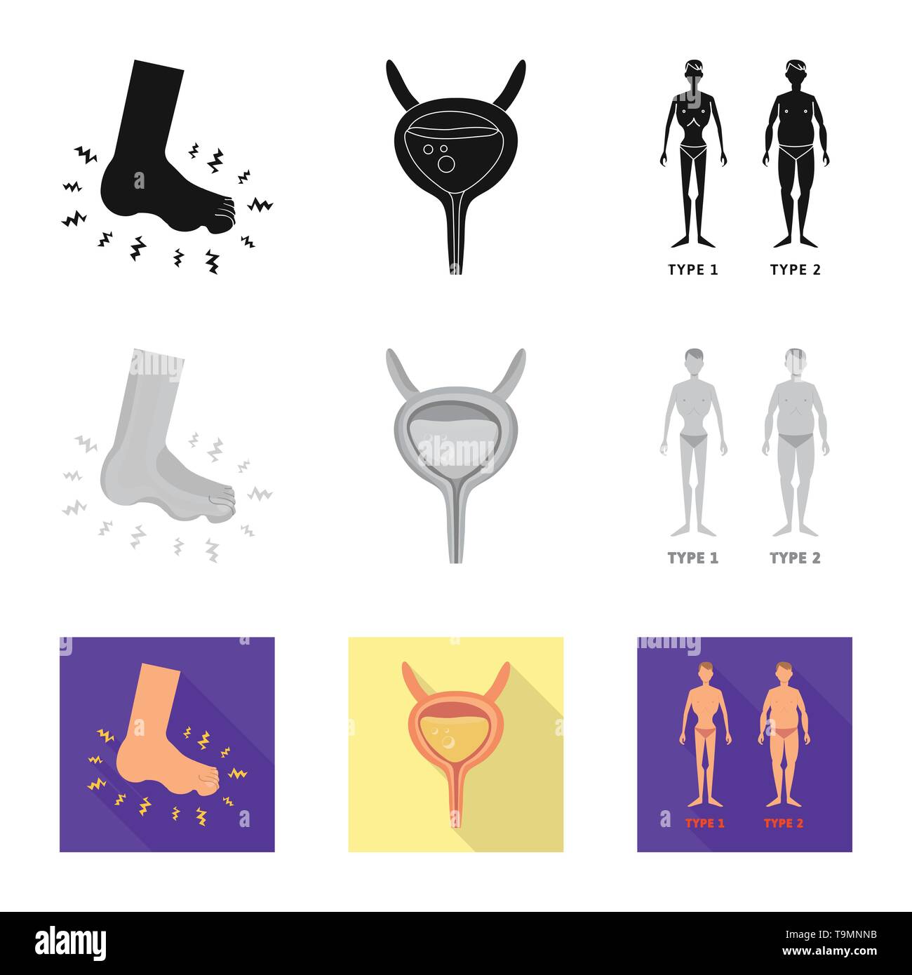 foot,incontinence,men,flatfoot,bladder,obese,plantar,infection,fitness ...