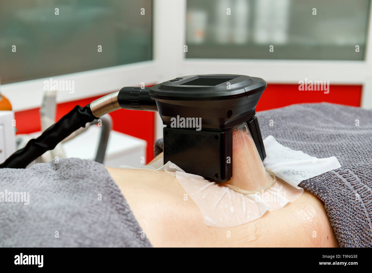 Cryolipolysis freeze fat procedure in cosmetic cabinet or spa salon ...