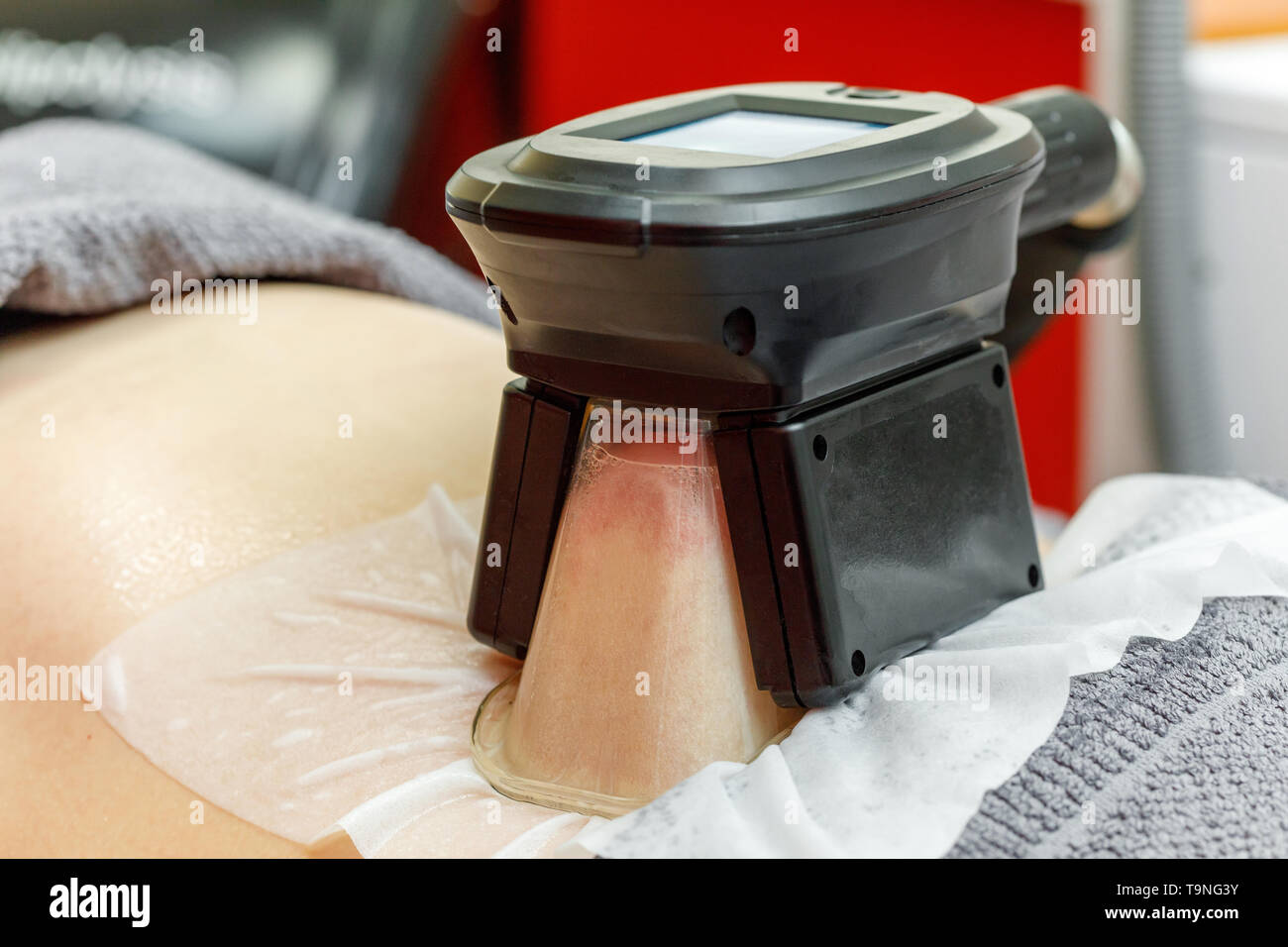 Cryolipolysis freeze fat procedure in cosmetic cabinet or spa salon ...