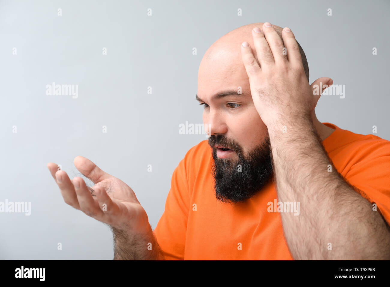 Man with hair loss problem on light background Stock Photo - Alamy