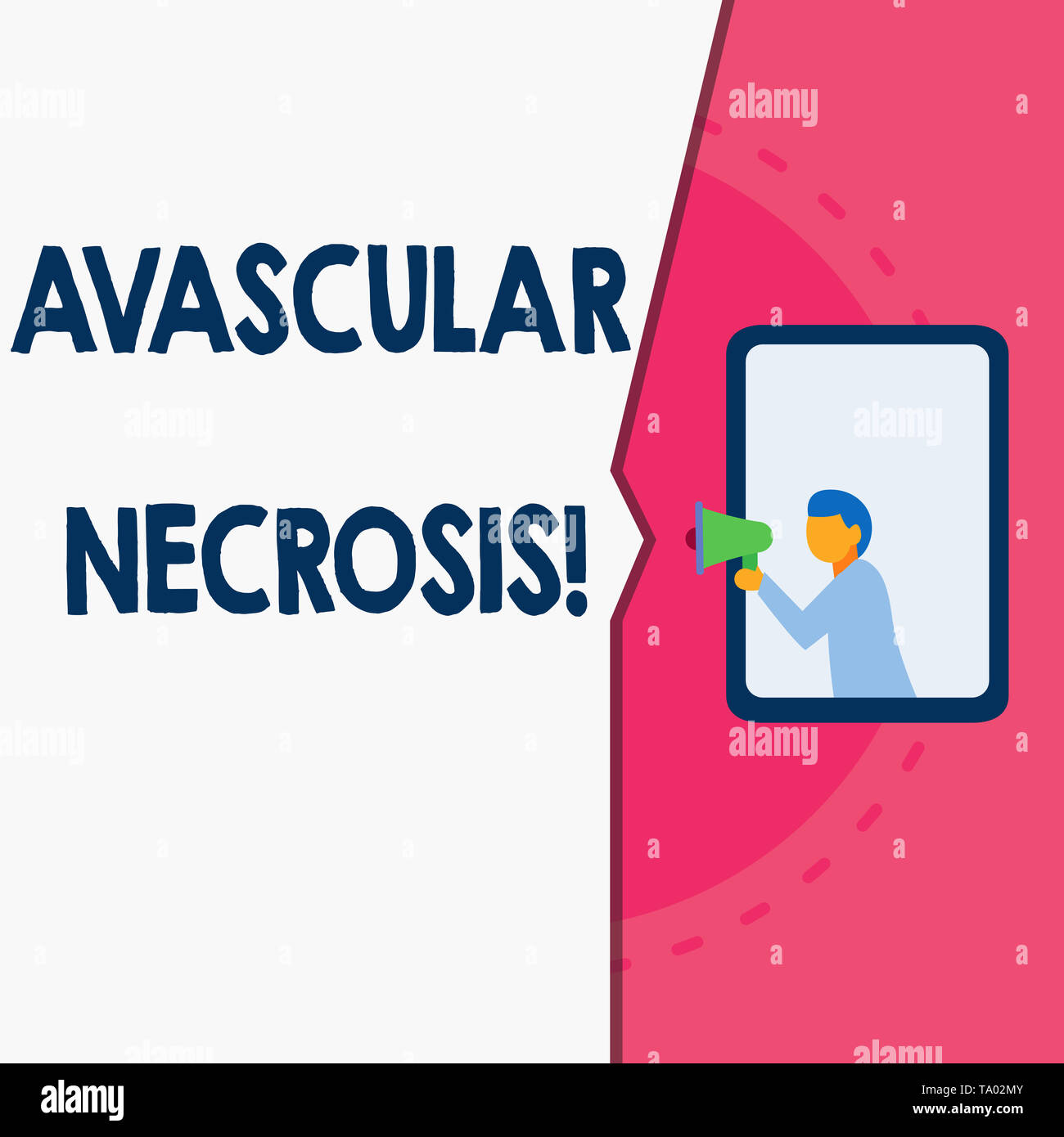Word writing text Avascular Necrosis. Business photo showcasing death ...