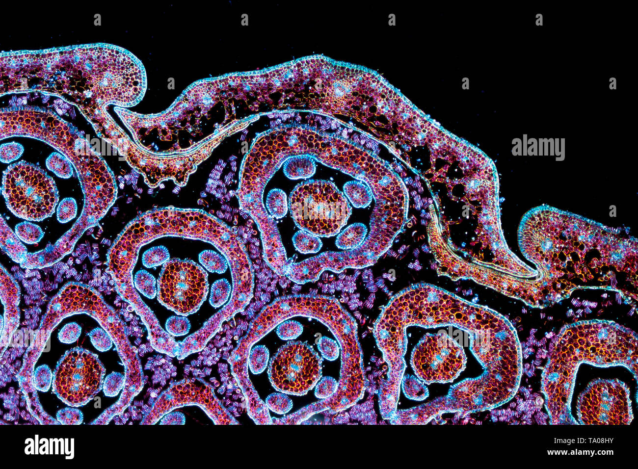 Stained transverse section ts hi-res stock photography and images - Alamy