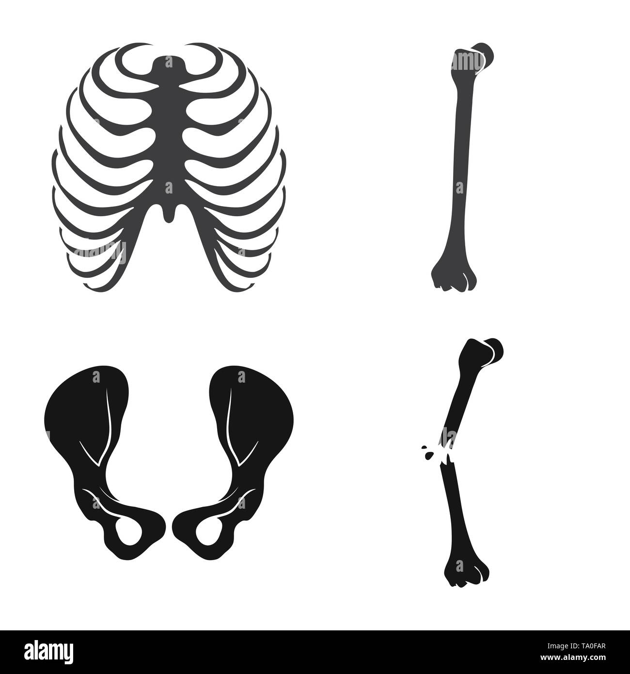 rib,hip,fracture,cage,broken,joint,pain,xray,fibula,pelvis,bias,body ...