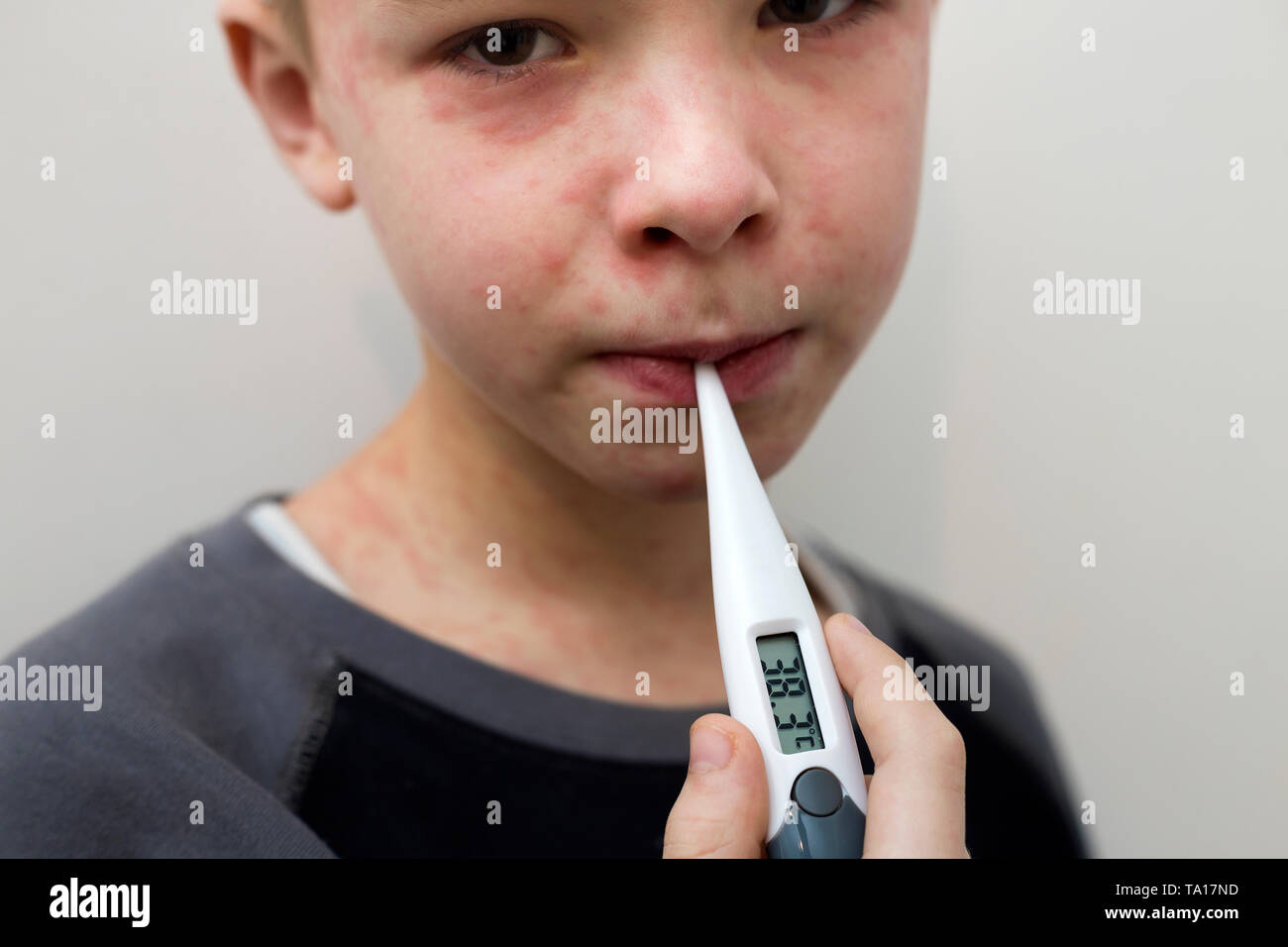Portrait of sick sad boy child with thermometer having fever suffering ...