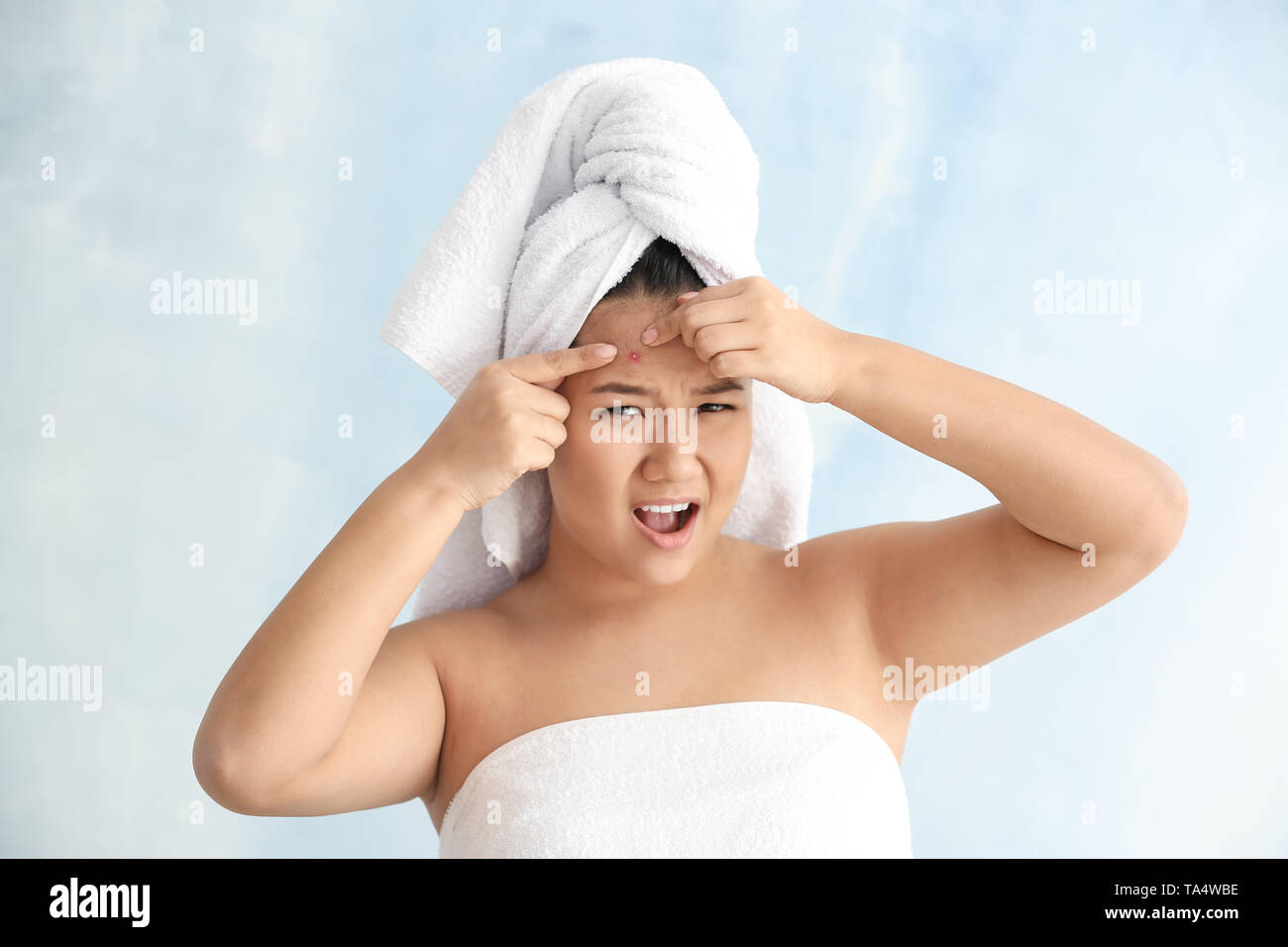 Portrait Of Young Asian Woman With Acne Problem Squishing Pimples On